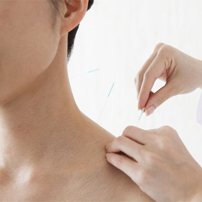 Spring Chiropractor Chiropractic Spring Texas Chiropractors TX 77386